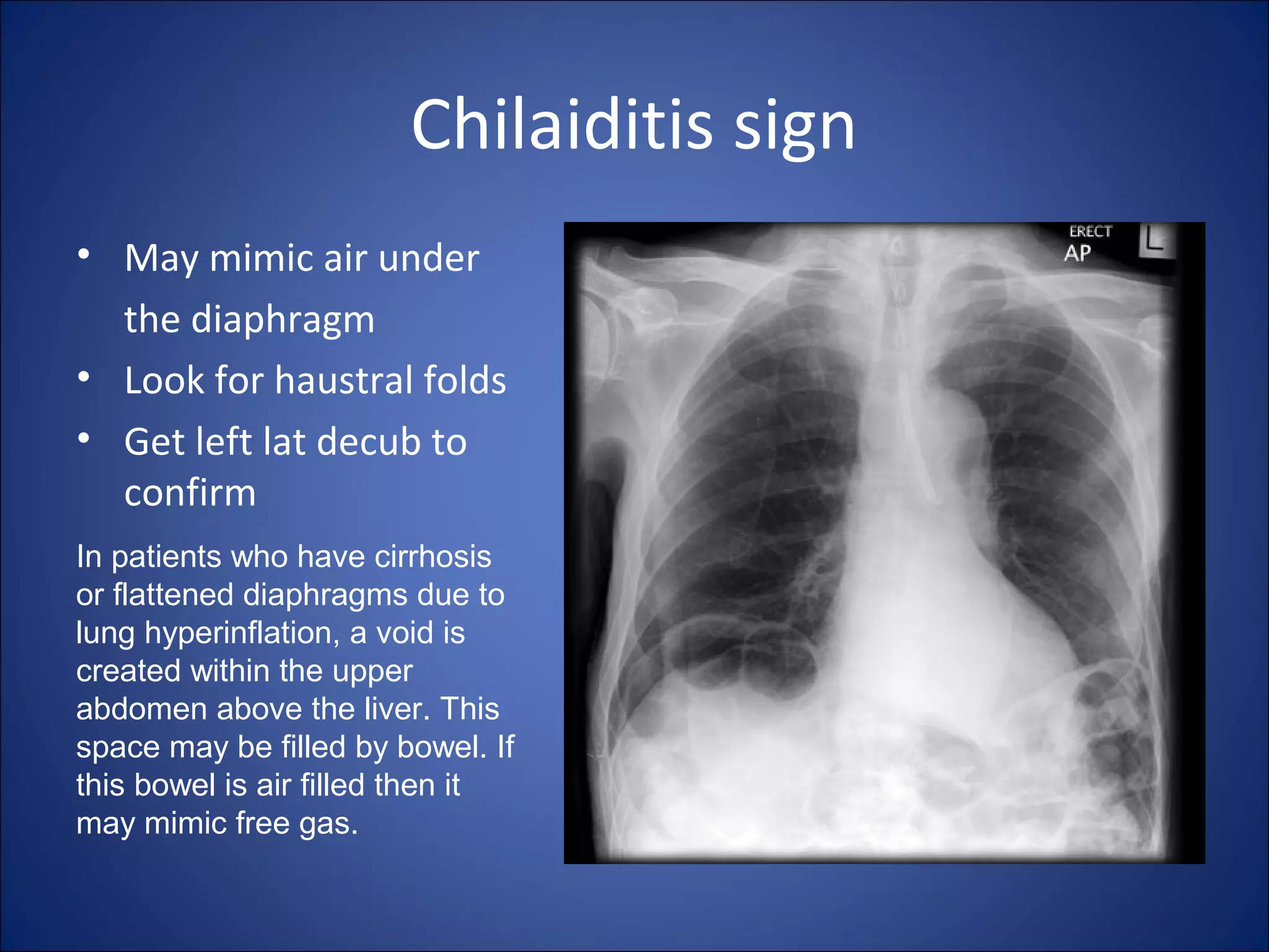 Abdominal X ray | PDF