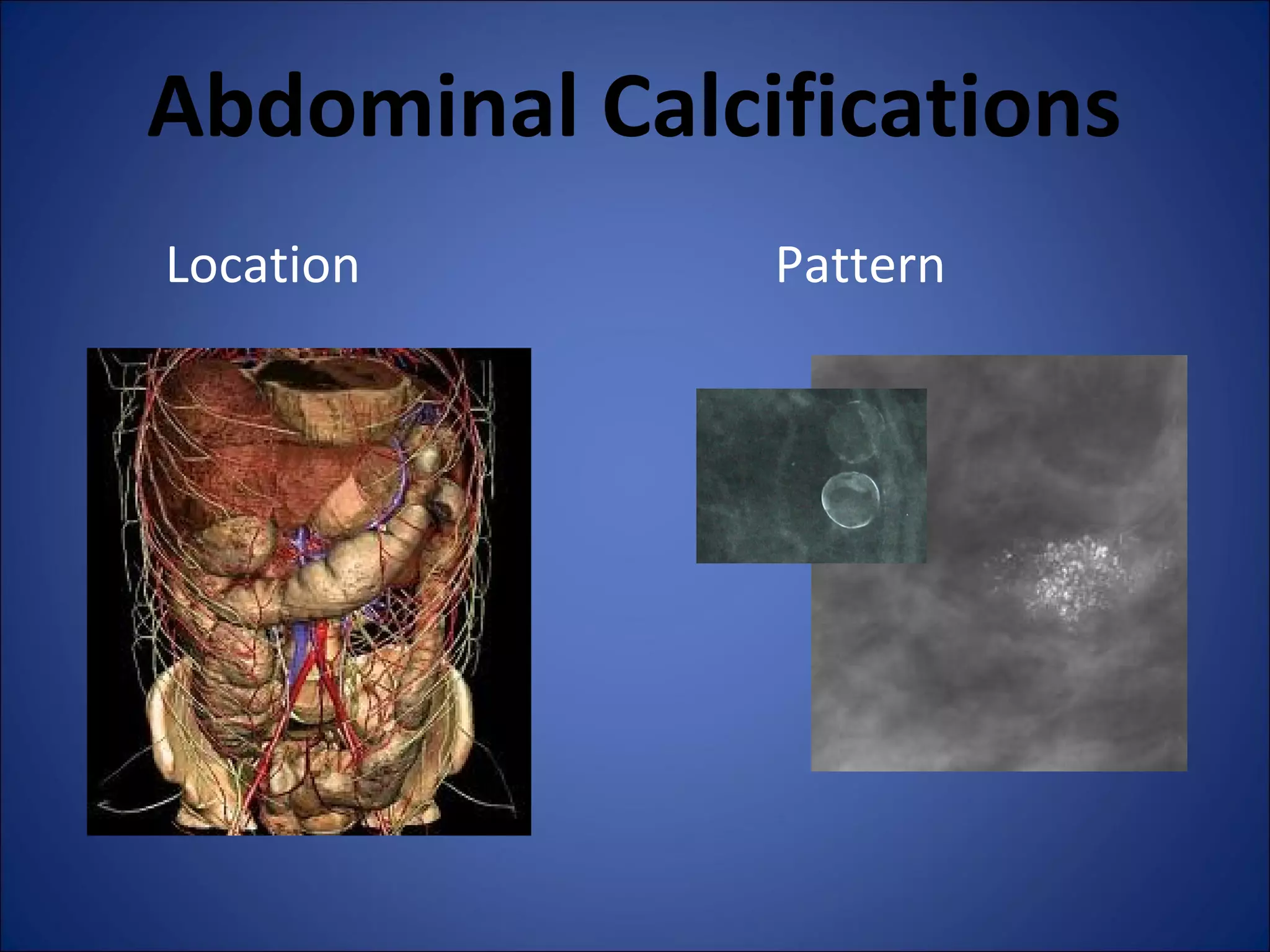 Abdominal X ray | PDF