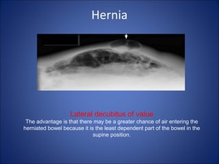 Abdominal X ray | PDF
