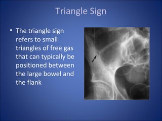 Abdominal X ray | PDF