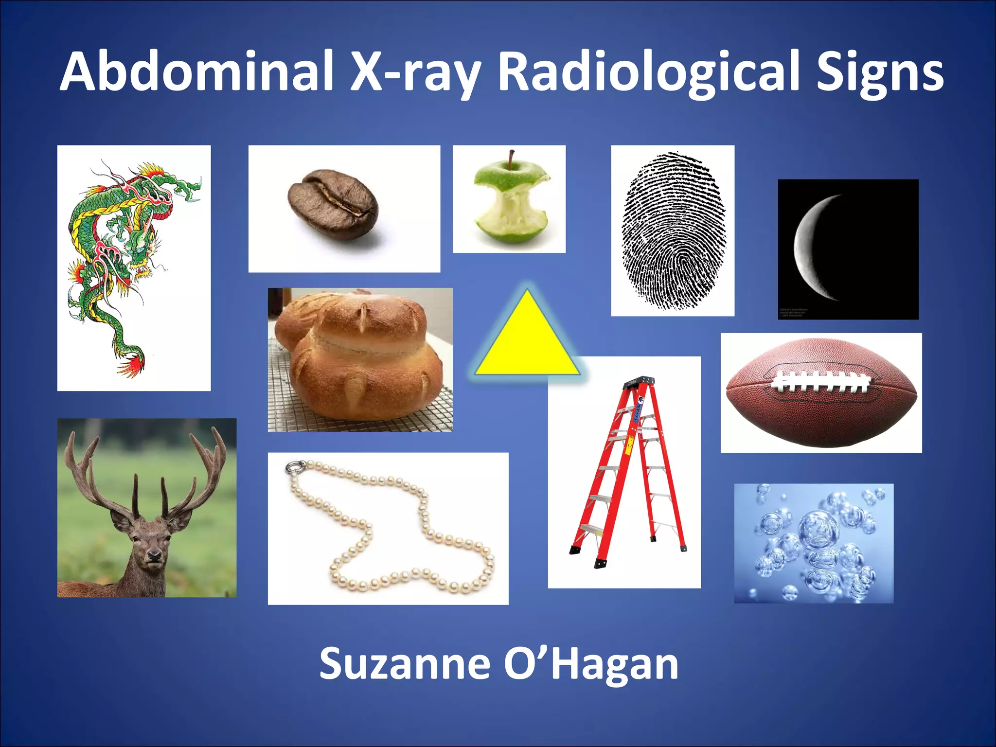 Abdomen xray signs | PPT