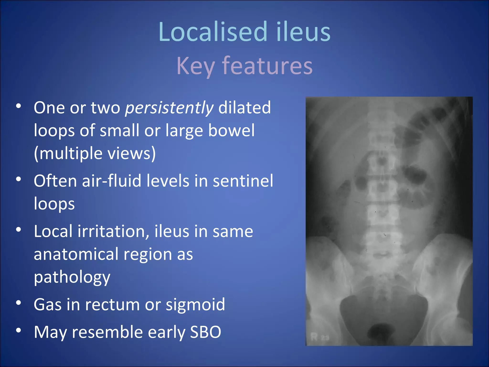 Abdomen xray signs | PPT