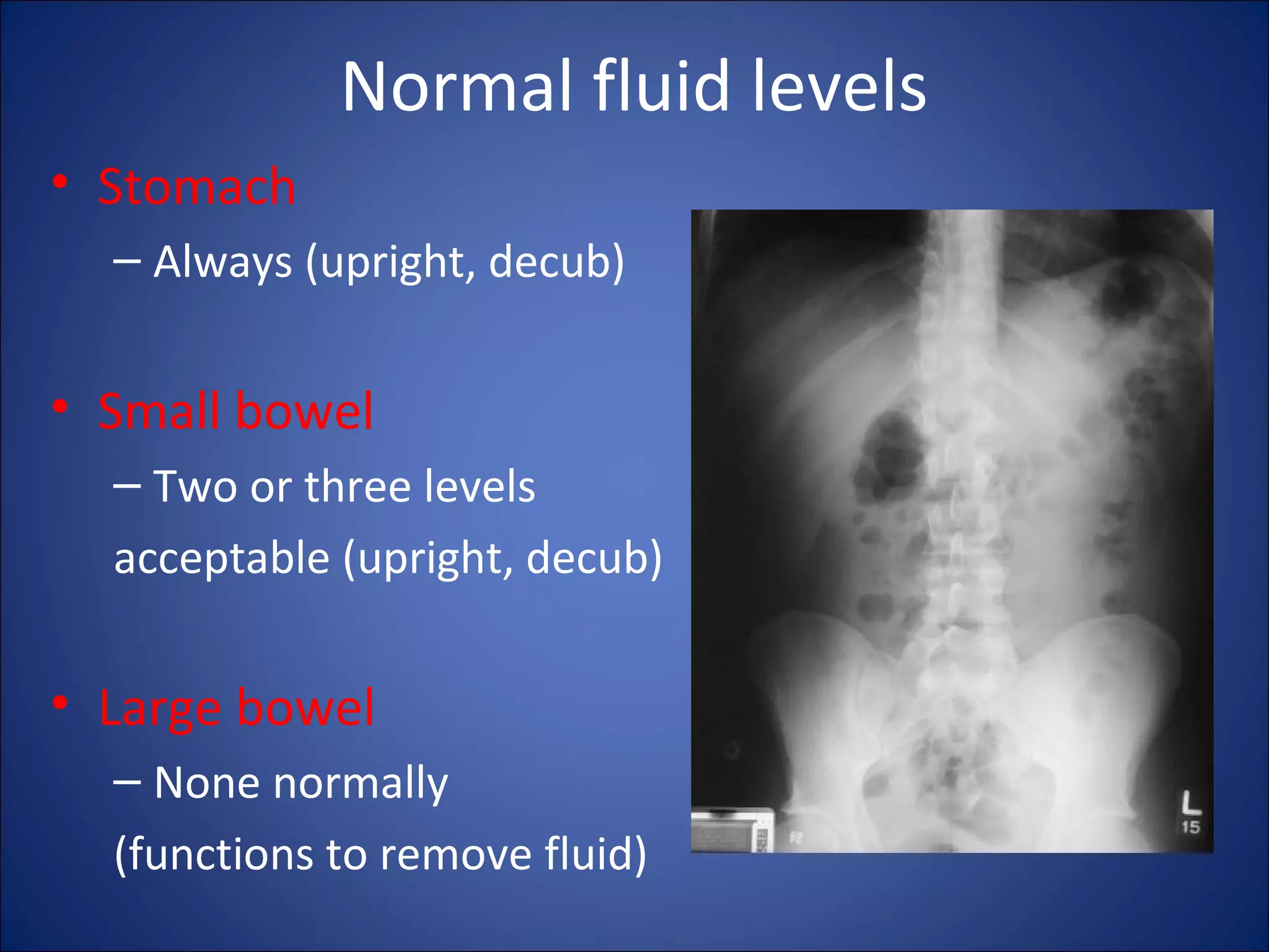 Abdomen xray signs | PPT