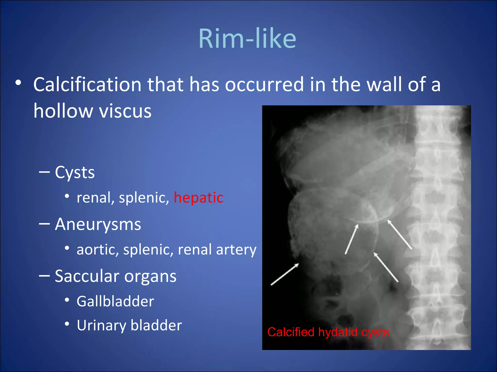 Abdomen xray signs | PPT