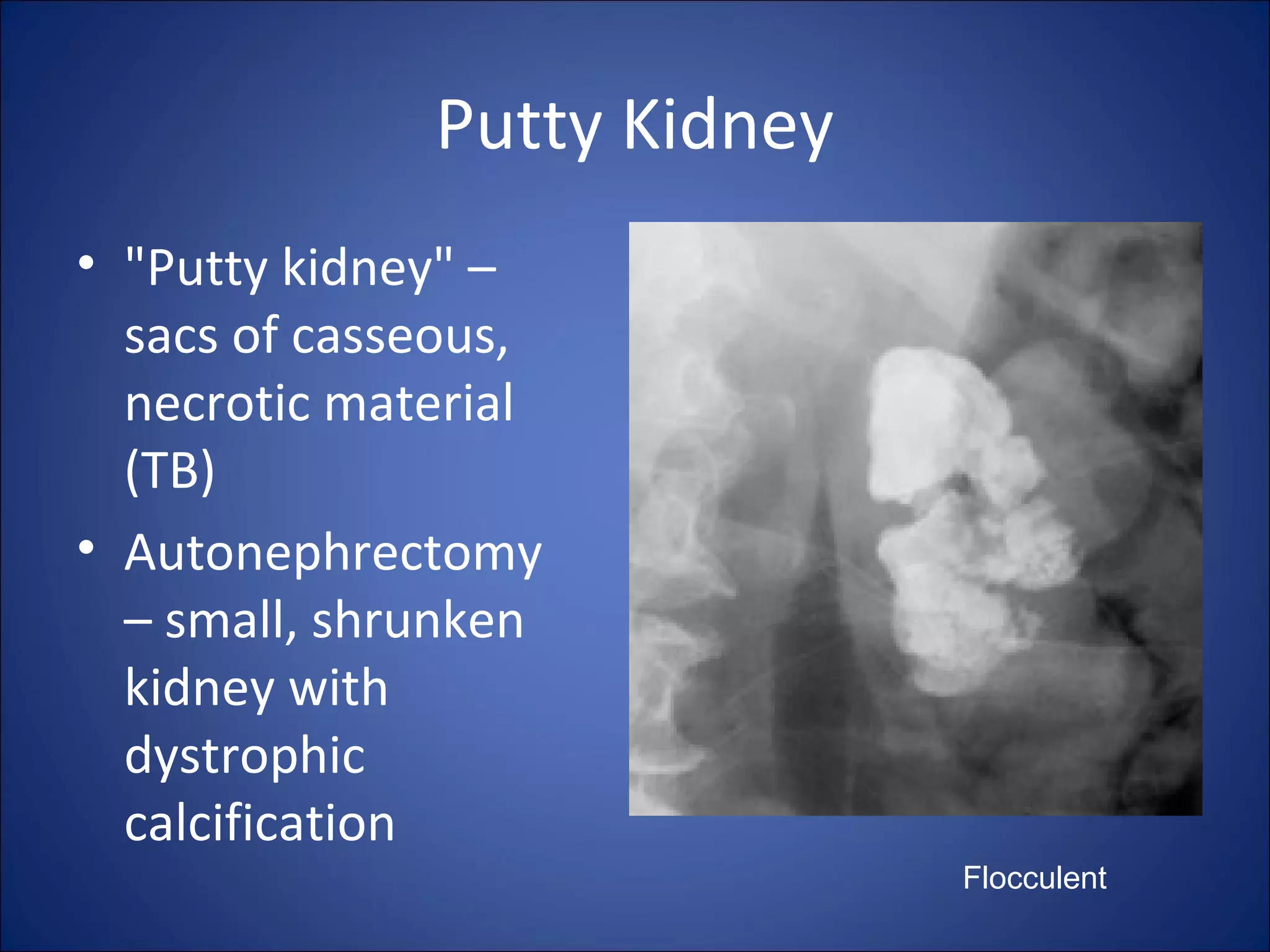 Abdomen xray signs | PPT