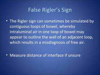 Abdomen xray signs | PPT