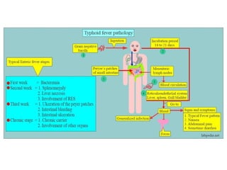 typhoid fever full notes with explanation | PPTX