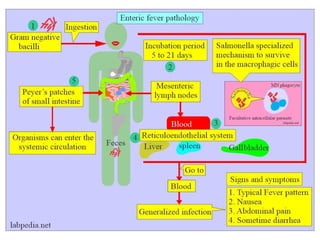 typhoid fever full notes with explanation | PPTX