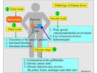 typhoid fever full notes with explanation | PPTX