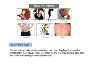 typhoid fever full notes with explanation | PPTX