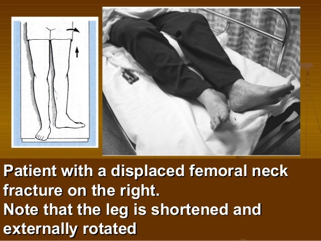 Positioning For Femur Fracture – CRHM
