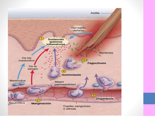 Proceso inflamatorio en inmunología