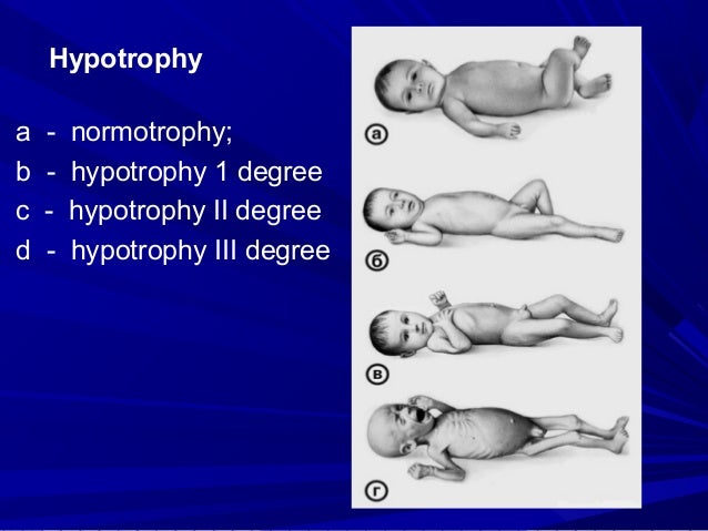 Energetic exchange in children. Protein metabolism & semiotics impair…