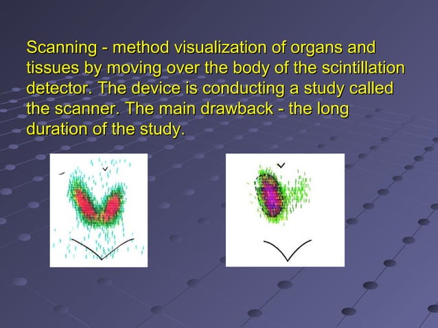 Radionuclide Imaging | PPT