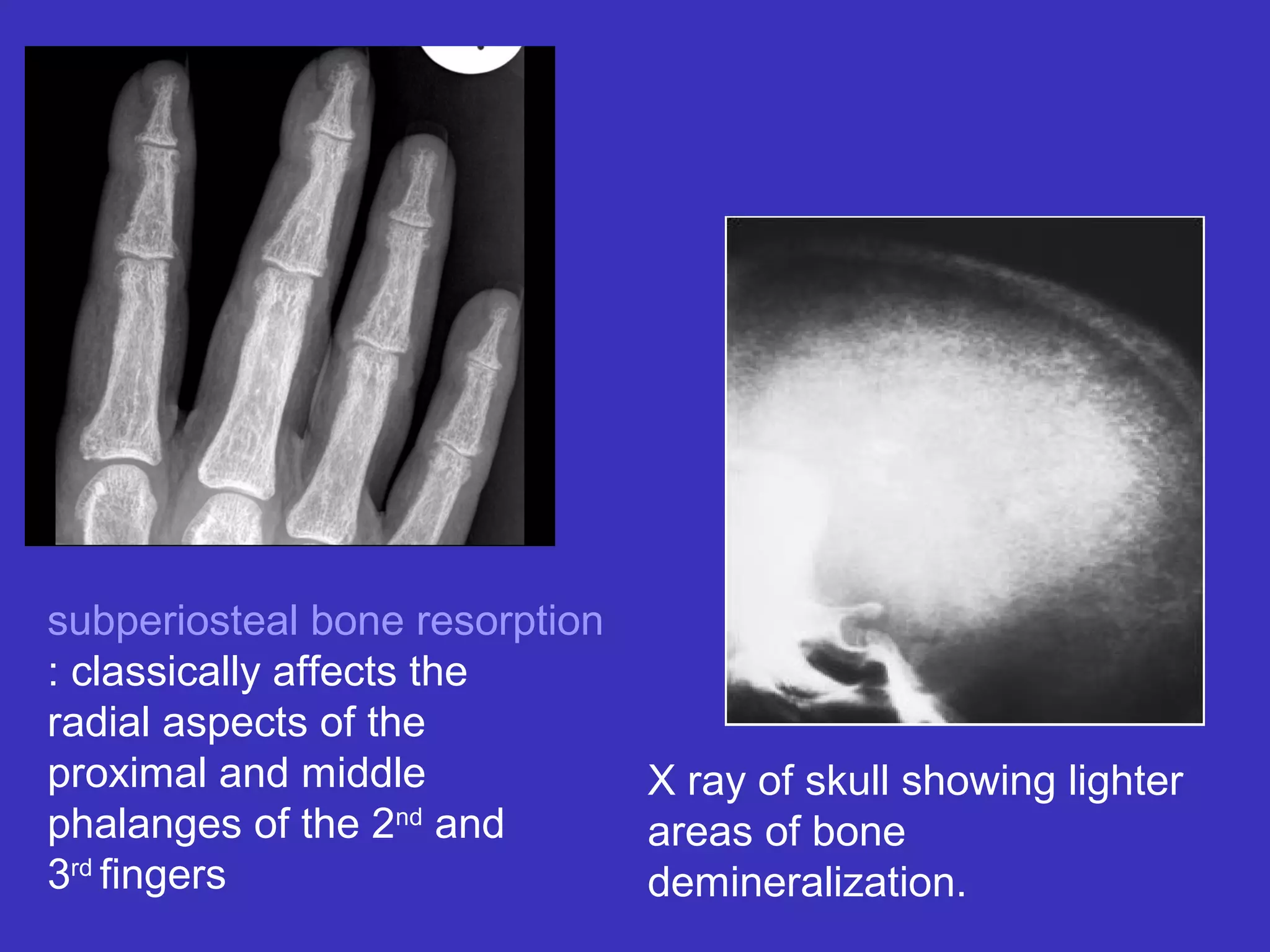 Musculo skeletal diseases | PPT