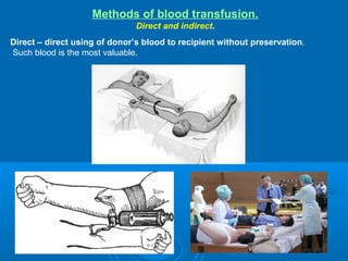 Doctrine about Blood. Test before hemo-transfusion | PPT