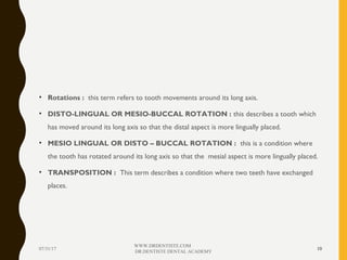 CLASSIFICATION OF MALOCCLUSION | PPT