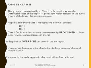 CLASSIFICATION OF MALOCCLUSION | PPT