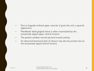 CLASSIFICATION OF MALOCCLUSION | PPT