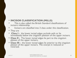 CLASSIFICATION OF MALOCCLUSION | PPT