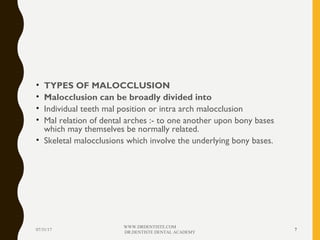 CLASSIFICATION OF MALOCCLUSION | PPT