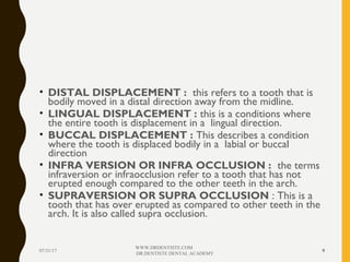 CLASSIFICATION OF MALOCCLUSION | PPT