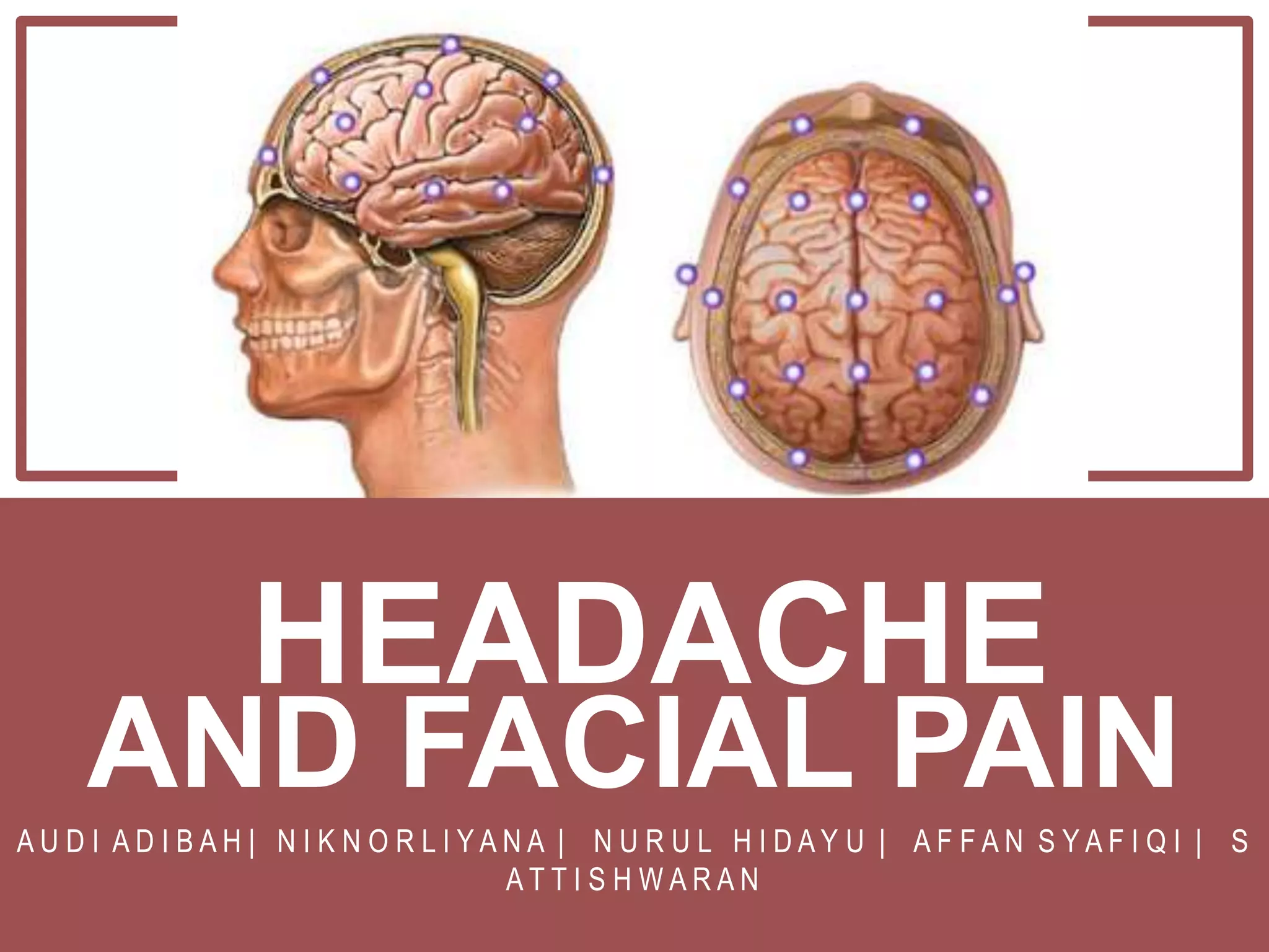 Headache & Facial pain | PPTX
