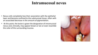 oral pigmented lesions | PPTX