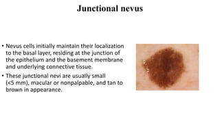 oral pigmented lesions | PPTX