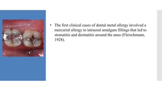 allergic reaction to restorative materials | PPTX