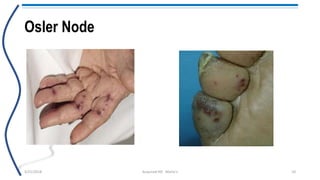 acquired heart disease | PPTX