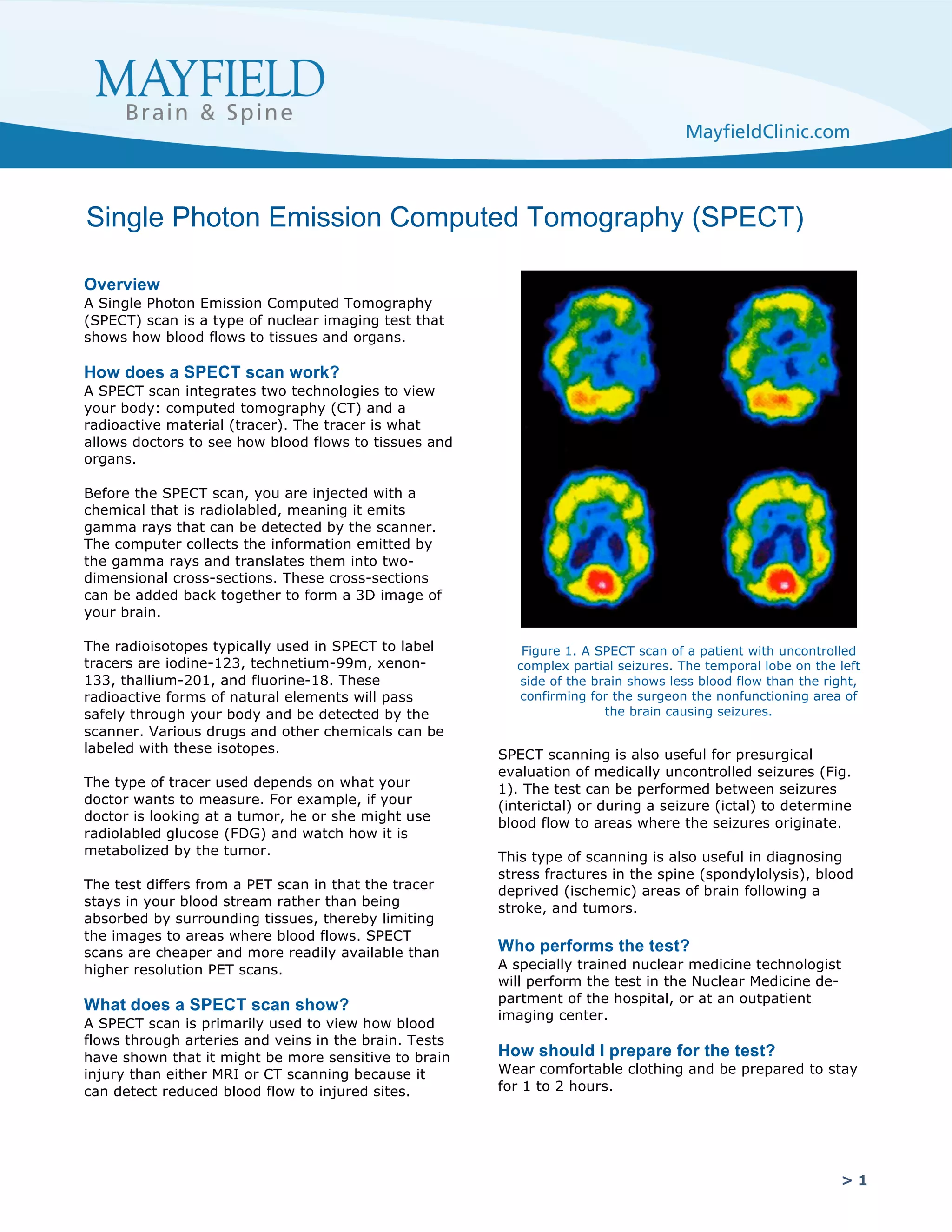 SPECT Scan | PDF