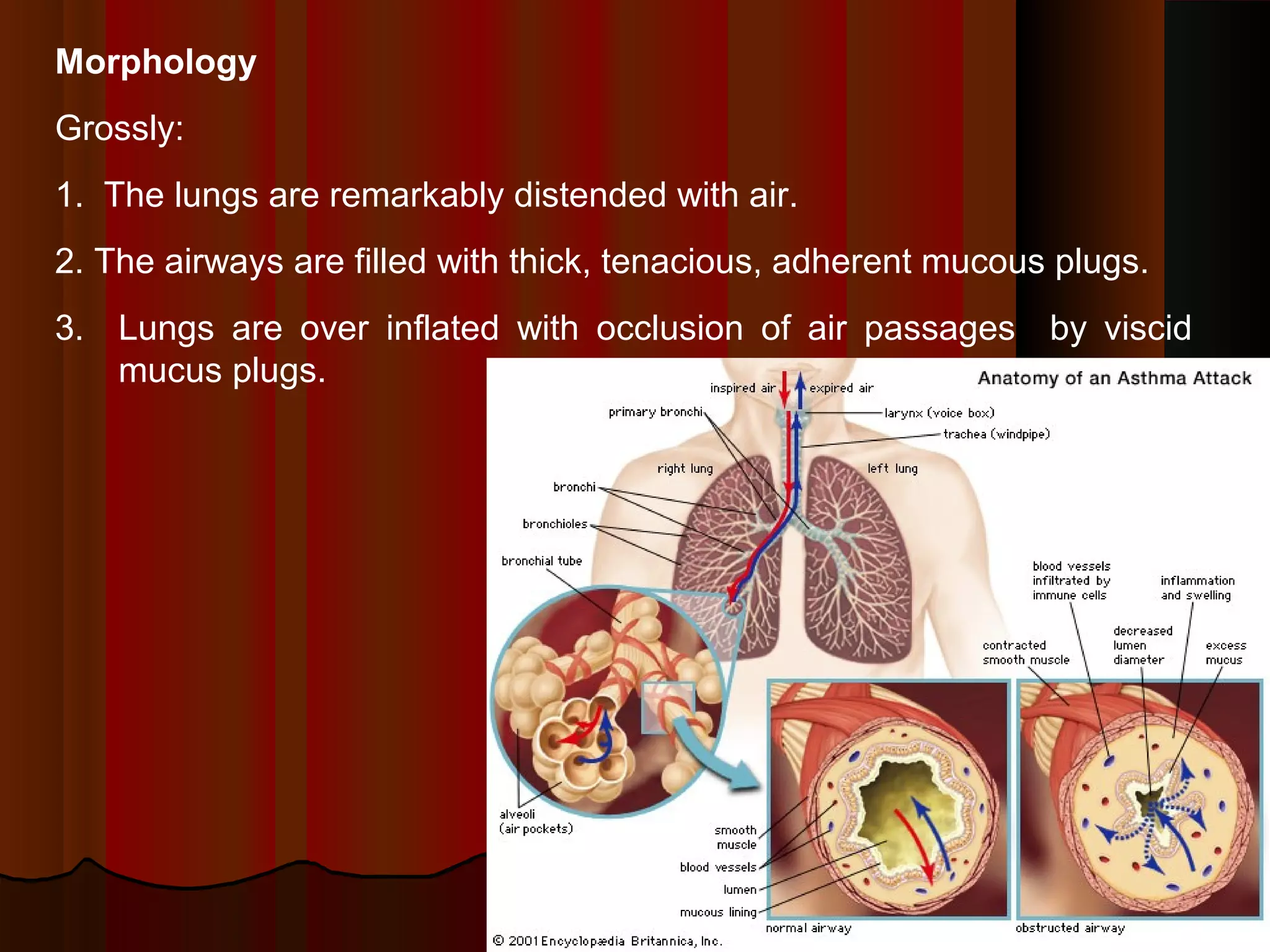 7.bronchial asthma | PPT