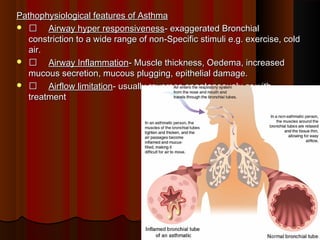 7.bronchial asthma | PPT