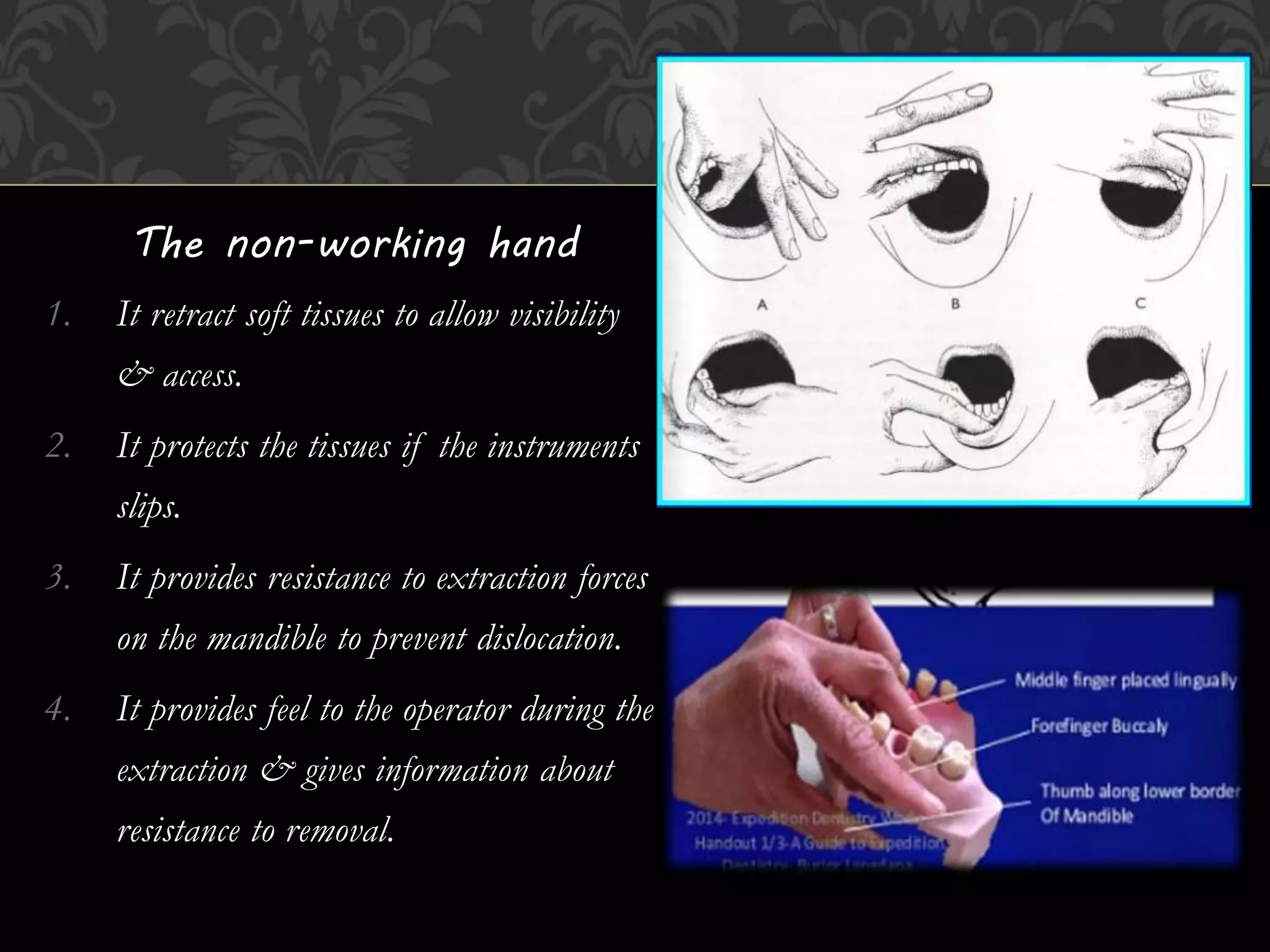 minor oral surgical procedures in pediatric dentistry | PPTX