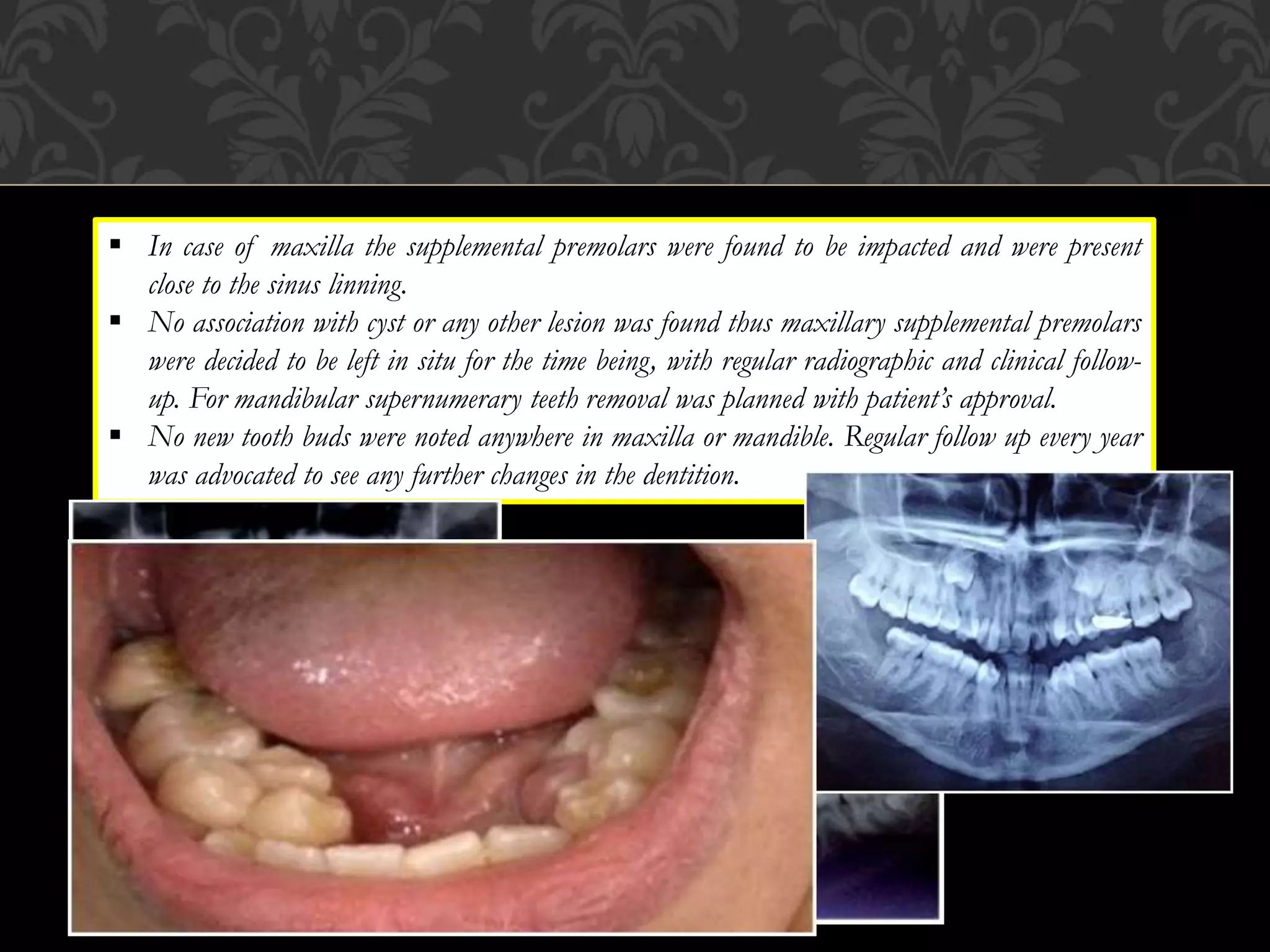 minor oral surgical procedures in pediatric dentistry | PPTX