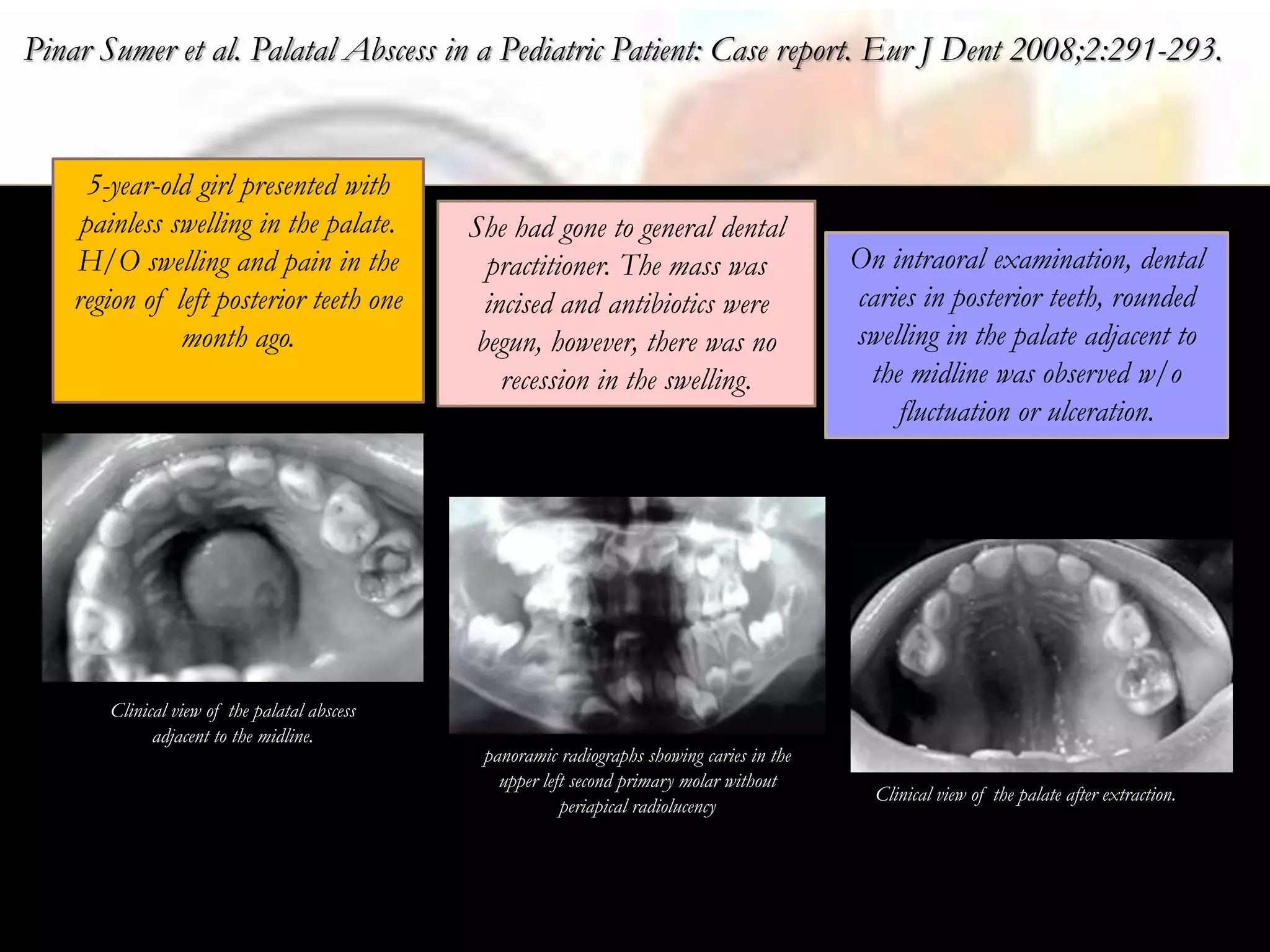 minor oral surgical procedures in pediatric dentistry | PPTX