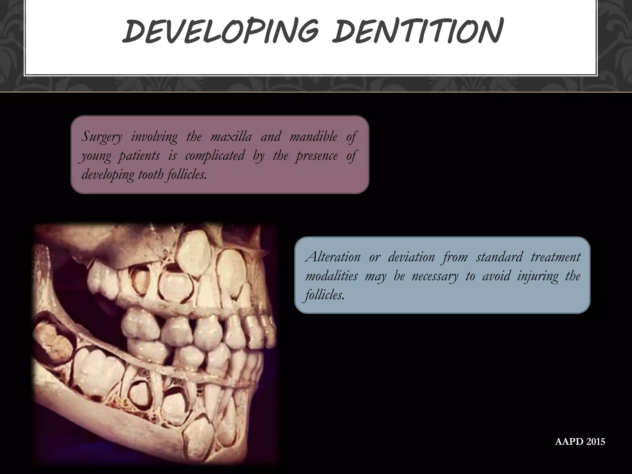 minor oral surgical procedures in pediatric dentistry | PPTX