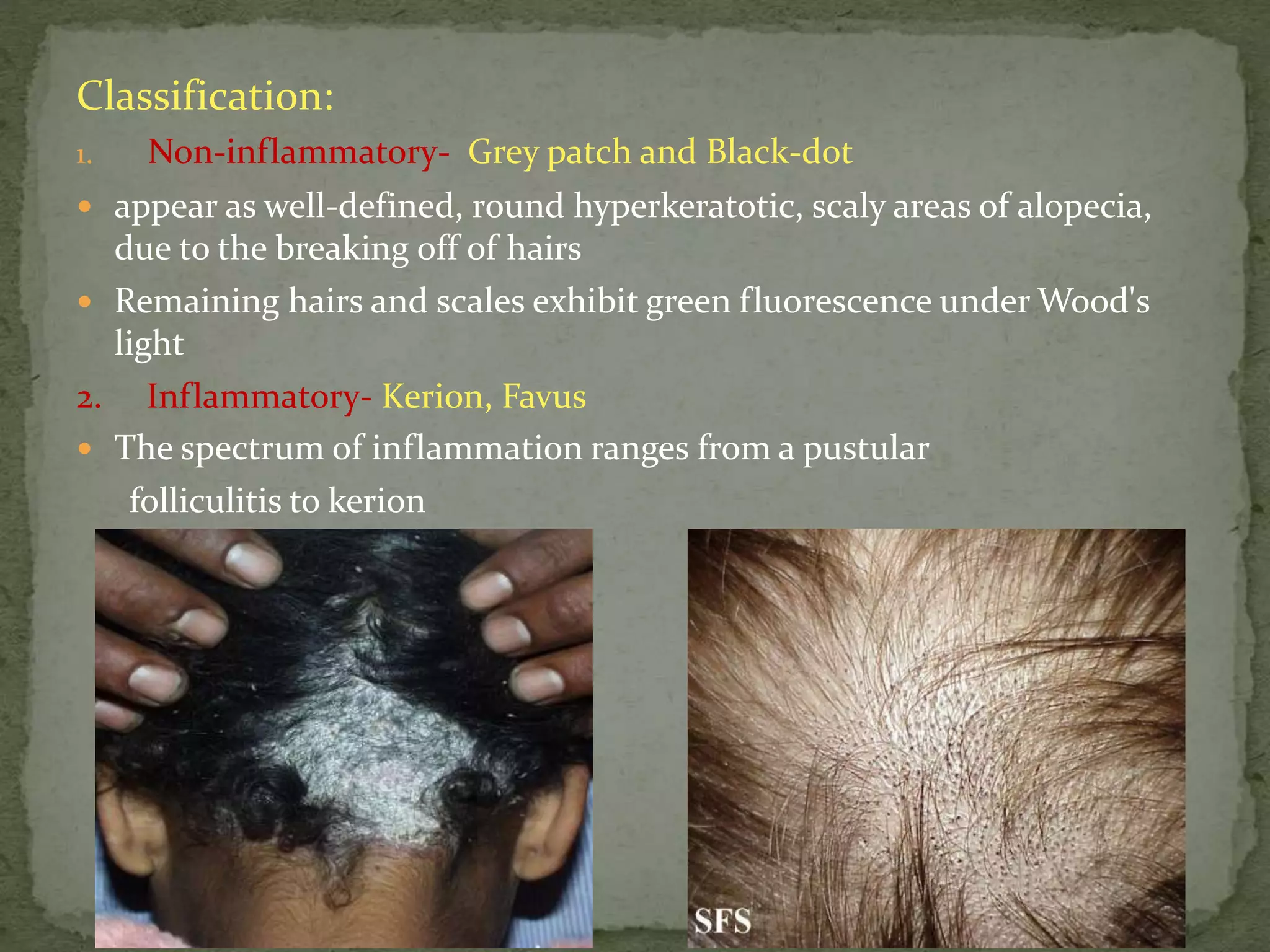 7. Fungal infections | PPTX