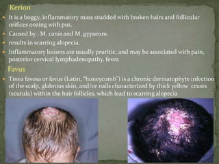 7. Fungal infections | PPTX