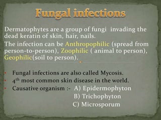 7. Fungal infections | PPTX