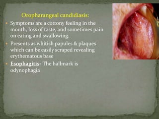 7. Fungal infections | PPTX