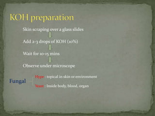 7. Fungal infections | PPTX