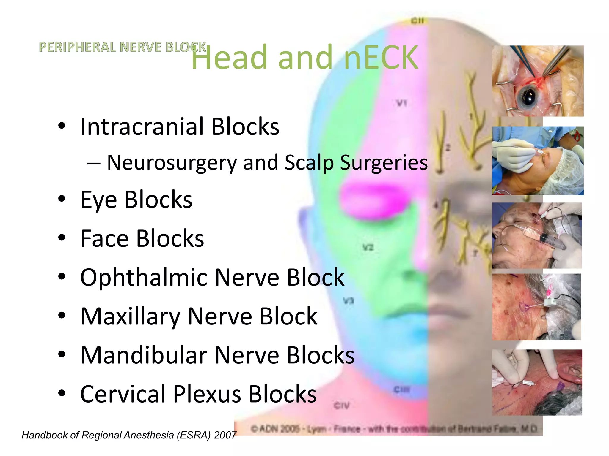 7. 1. anesthesia | PDF