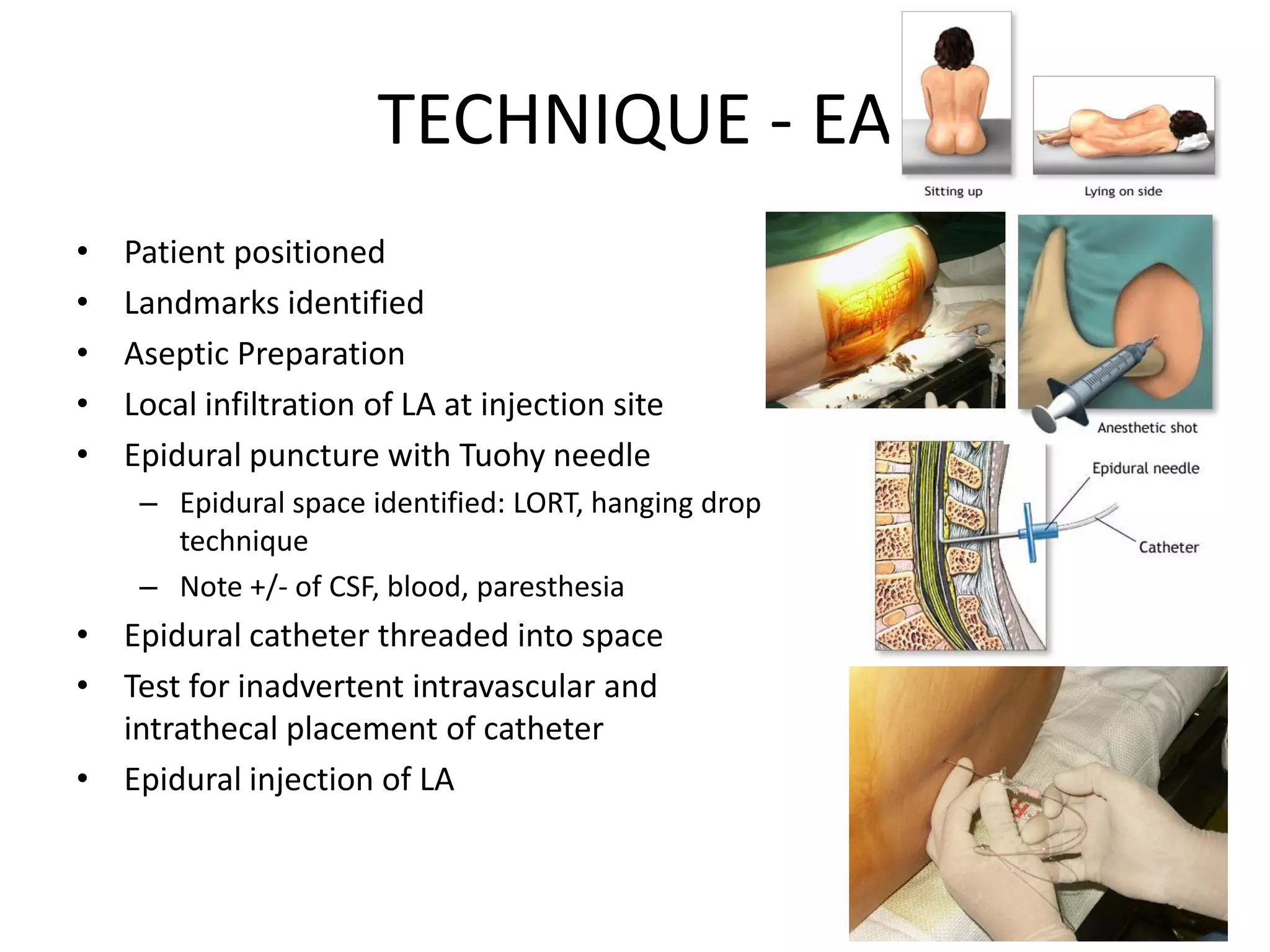 7. 1. anesthesia | PDF
