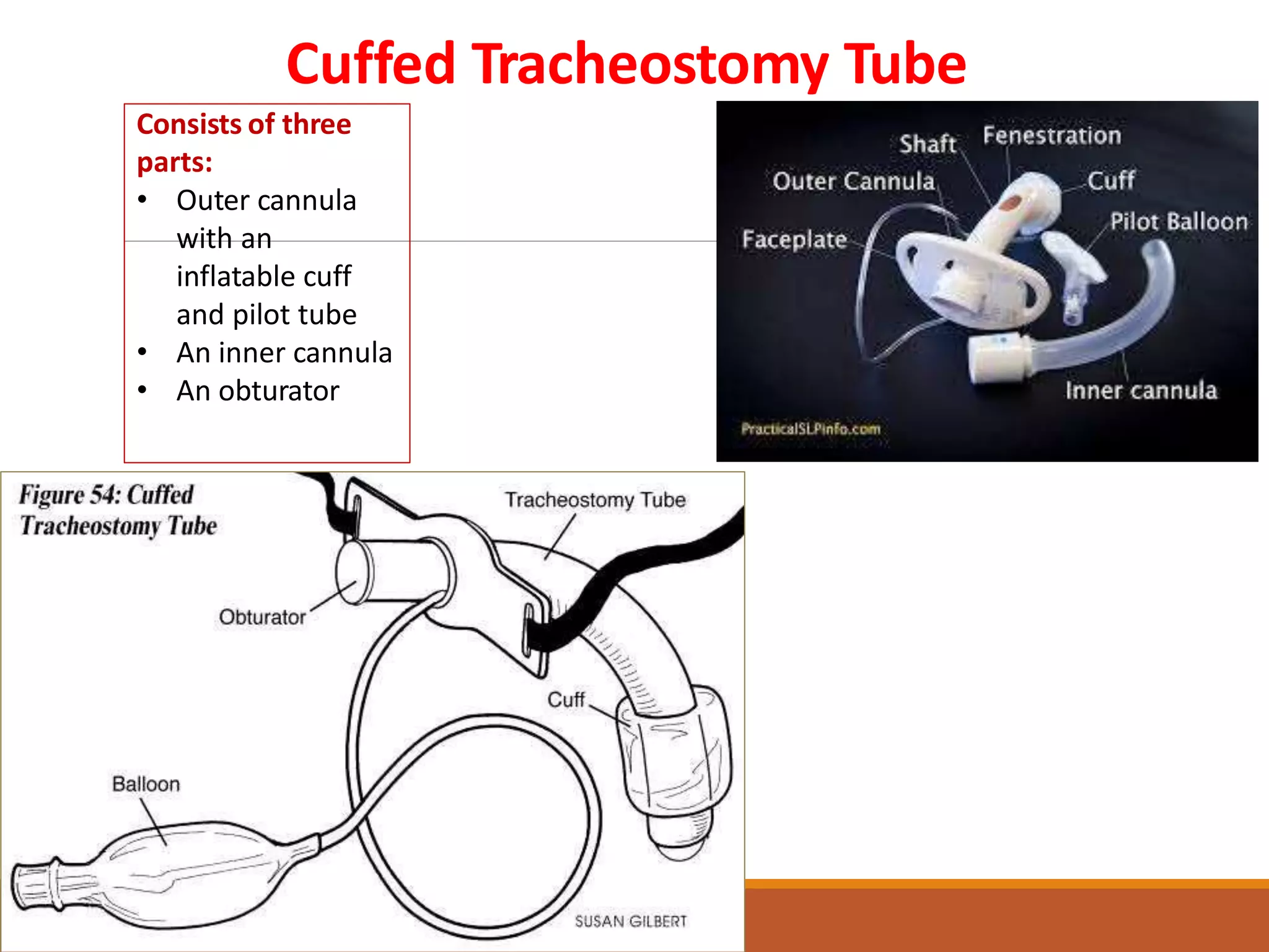 Tracheostomy care | PPTX