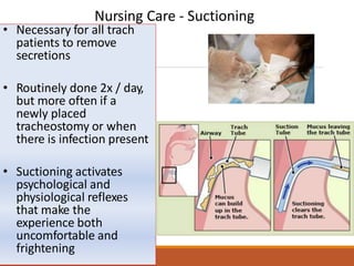 Tracheostomy care | PPTX
