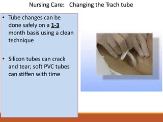 Tracheostomy care | PPTX