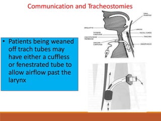 Tracheostomy care | PPTX