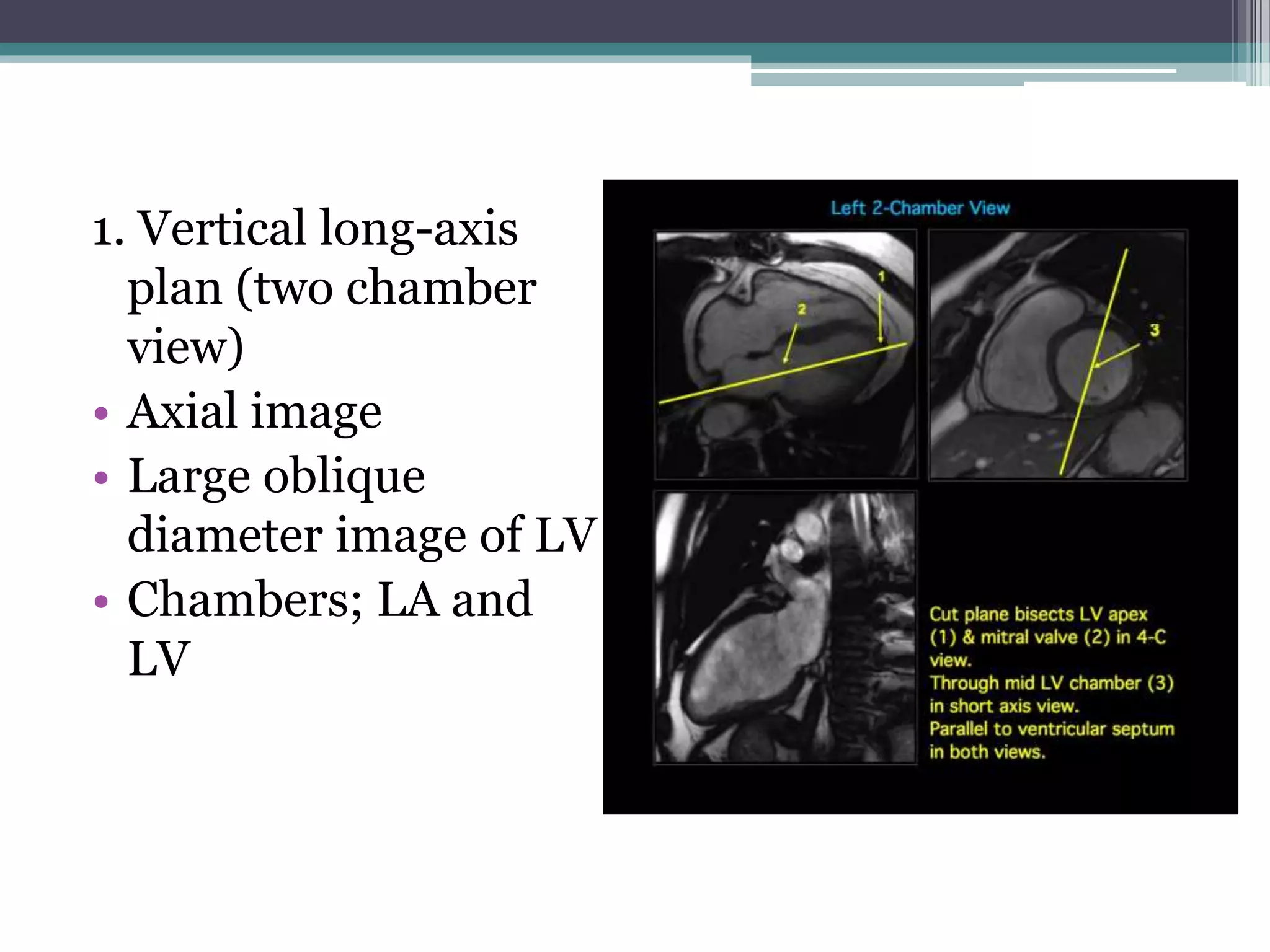 Cardiac Magnetic Resonance Imaging | PPTX